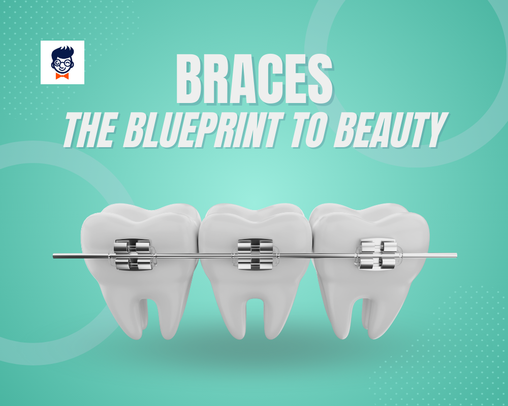 741+ Best Braces Slogans and taglines (Generator + Guide) - Thebrandboy.com